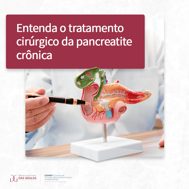 Entenda o tratamento cirúrgico da pancreatite crônica - Cighep