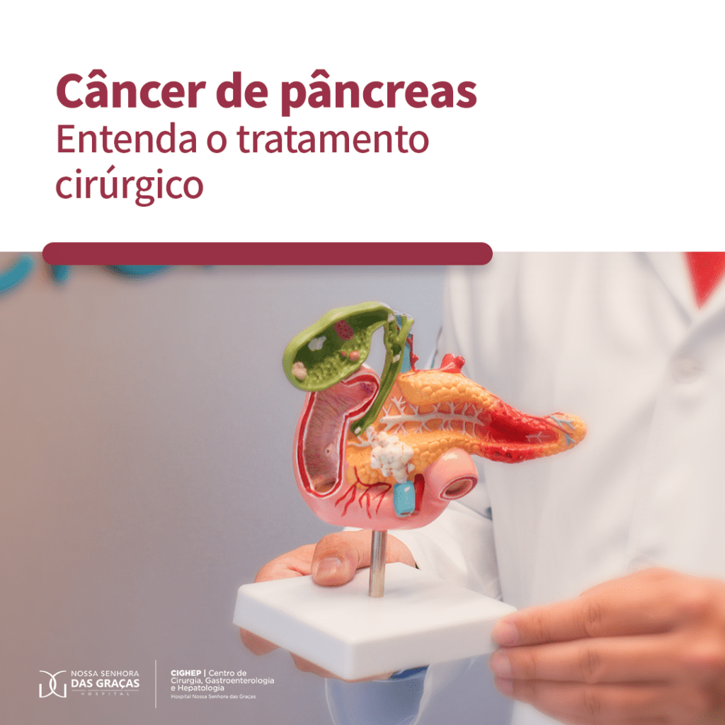 Câncer de pâncreas - Entenda o tratamento cirúrgico - Cighep